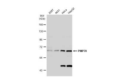PMP70 Antibody (NBP3-13153): Novus Biologicals