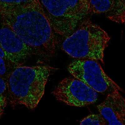 PREX2 Antibody (NBP2-56590): Novus Biologicals