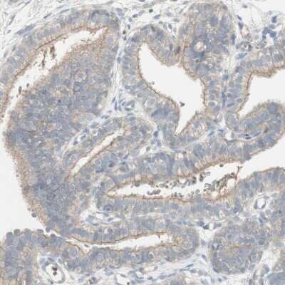 PTGER4/EP4 Antibody (NBP1-84834): Novus Biologicals