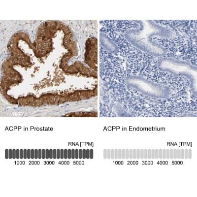 Prostatic Acid Phosphatase/ACPP Antibody (NBP1-90263): Novus Biologicals