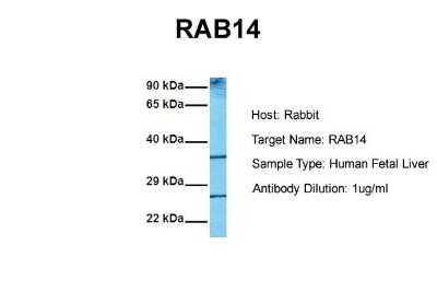 RAB14 Antibodies: Novus Biologicals