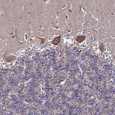 RAB15 Antibody (NBP1-86231): Novus Biologicals