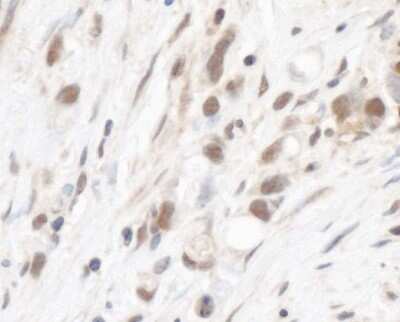 RPL5 Antibody (NBP2-22285): Novus Biologicals