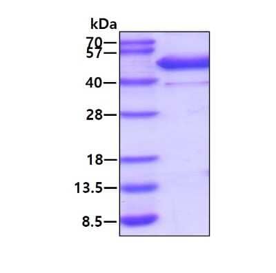 Recombinant Human CKMT2 His Protein (NBP1-98930): Novus Biologicals