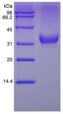 Recombinant Human Erythropoietin/EPO Protein (NBP2-61250): Novus ...