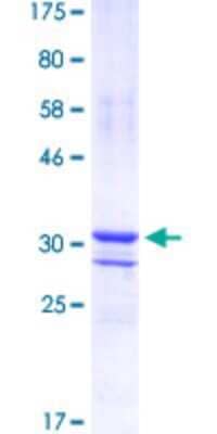 Recombinant Human Osterix/Sp7 GST (N-Term) Protein (H00121340-Q01 ...