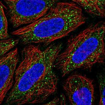 SARM1 Antibody (NBP1-87897): Novus Biologicals