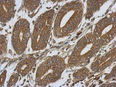 SIRP alpha/CD172a Antibody (NBP2-20370): Novus Biologicals