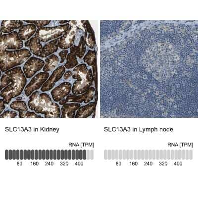 SLC13A3/NaDC3 Antibody (NBP1-82603): Novus Biologicals