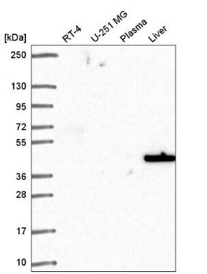SLC14A1 Antibody (NBP2-58203): Novus Biologicals