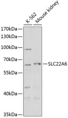 OAT1 Antibody (NBP2-94606): Novus Biologicals