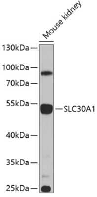 SLC30A1 Antibody (NBP2-94196): Novus Biologicals