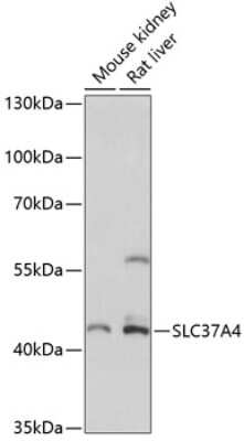 SLC37A4 Antibody (NBP2-93652): Novus Biologicals