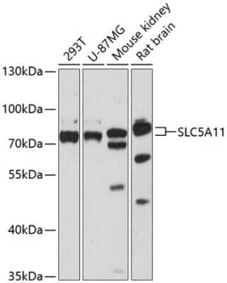 SLC5A11 Antibody (NBP2-93586): Novus Biologicals