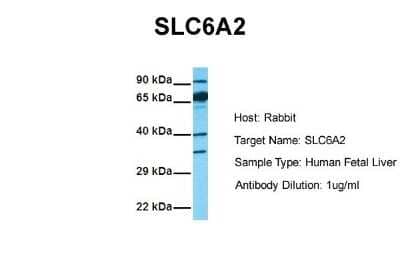 SLC6A2/NET/Noradrenaline transporter Antibody (NBP1-60120): Novus ...