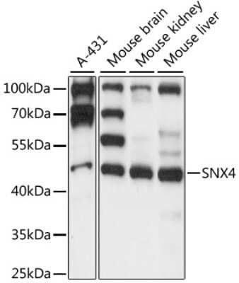 SNX4 Antibody (NBP2-94704): Novus Biologicals