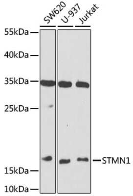 Stathmin 1 Antibody (NBP2-94766): Novus Biologicals