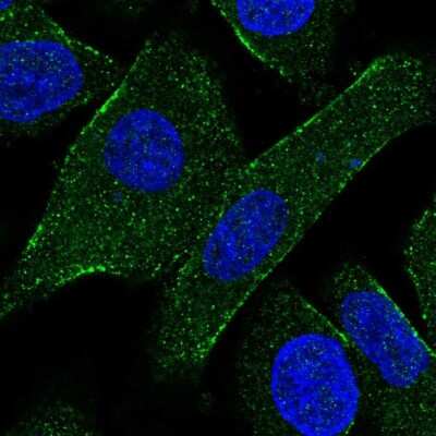 TGF-beta RI/ALK-5 Antibody (NBP2-58478): Novus Biologicals
