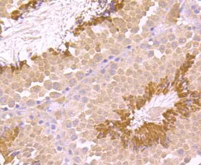 TGM6 Antibody (NBP2-75688): Novus Biologicals