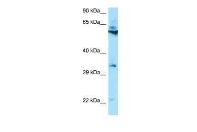 TMEM192 Antibody (NBP2-85943): Novus Biologicals
