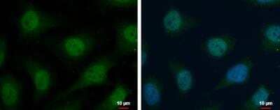 Thioredoxin Reductase 1/TRXR1 Antibody (NBP2-20620): Novus Biologicals