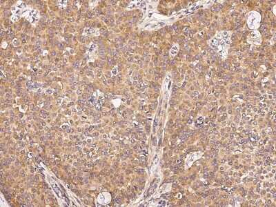 UBE4A Antibody (NBP2-98835): Novus Biologicals