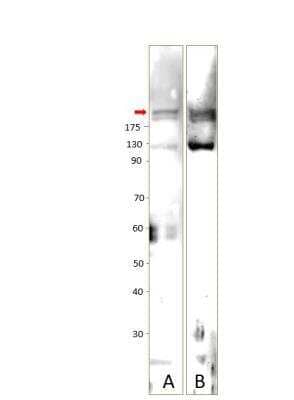 UBR1 Antibody (NBP3-12361): Novus Biologicals