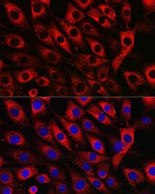 UFL1 Antibody (NBP3-16039): Novus Biologicals