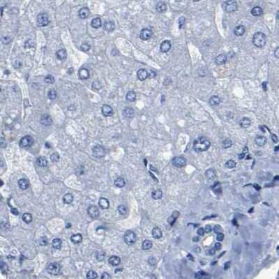 Uroplakin III Antibody (NBP1-86874): Novus Biologicals