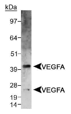 VEGF Antibody - BSA Free (NB100-2381): Novus Biologicals