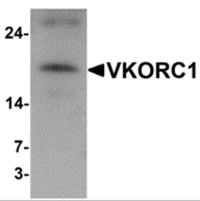 VKORC1 Antibody - BSA Free (NBP2-81859): Novus Biologicals