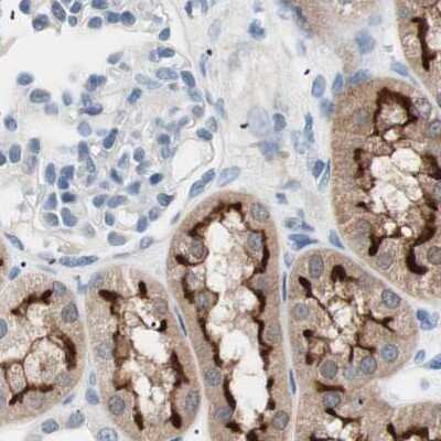 Villin 1 Antibody (NBP1-85335): Novus Biologicals