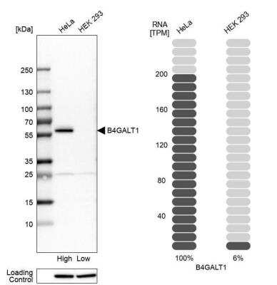 beta-1,4-Galactosyltransferase 1/B4GalT1 Antibody (NBP1-88654): Novus ...