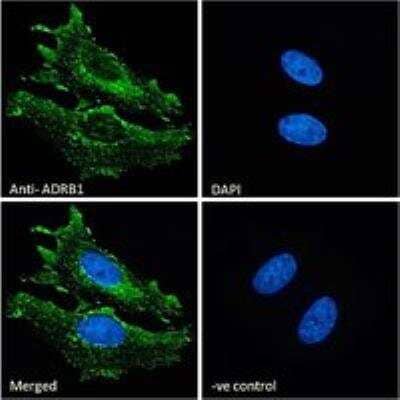beta-1 Adrenergic R/ADRB1 Antibody (NB600-978): Novus Biologicals