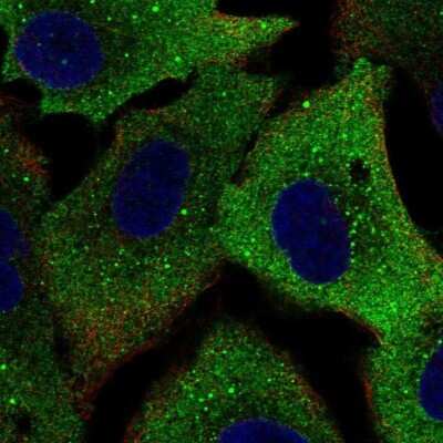 p62/SQSTM1 Antibodies: Novus Biologicals