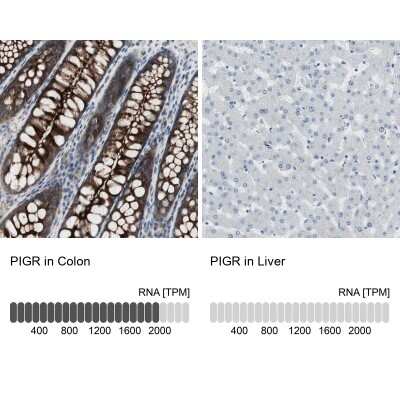 pIgR Antibody (NBP1-86504): Novus Biologicals