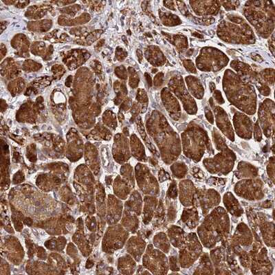 ALG11 Antibody (NBP1-93651): Novus Biologicals