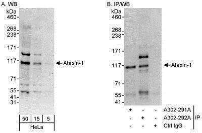 Ataxin 1 Antibody (NBP1-28734): Novus Biologicals