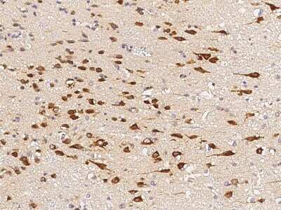 CIDEA Antibody (NBP2-98782): Novus Biologicals