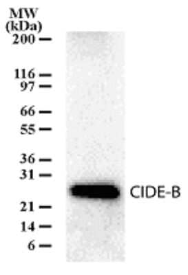 CIDEB Antibody (NB100-55757): Novus Biologicals