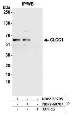 CLCC1 Antibody (NBP2-60705): Novus Biologicals