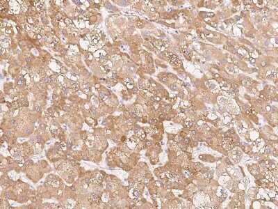 CLPTM1L Antibody (NBP2-99271): Novus Biologicals