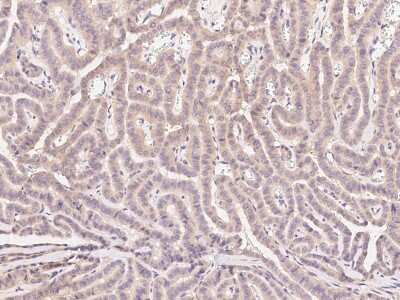CLPTM1L Antibody (NBP2-99271): Novus Biologicals