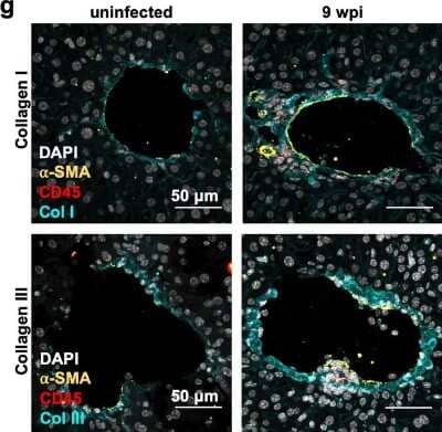 Collagen III alpha 1/COL3A1 Antibody - BSA Free (NB600-594): Novus ...