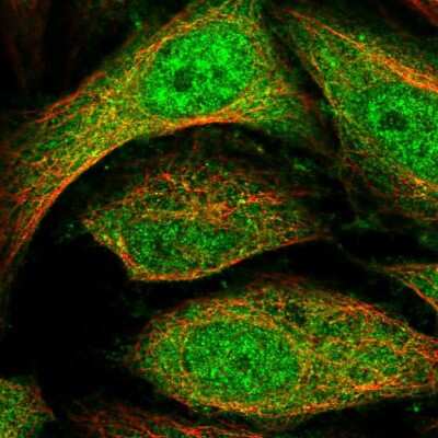 FBXO2 Antibody (NBP2-55140): Novus Biologicals