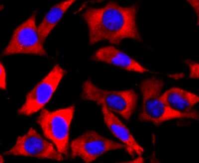 FMRP Antibody (JM91-41) (NBP2-66848): Novus Biologicals