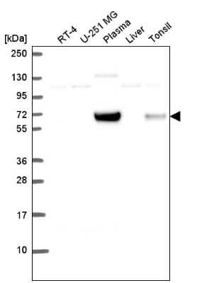 Glucagon R/GCGR Antibody (NBP2-55921): Novus Biologicals