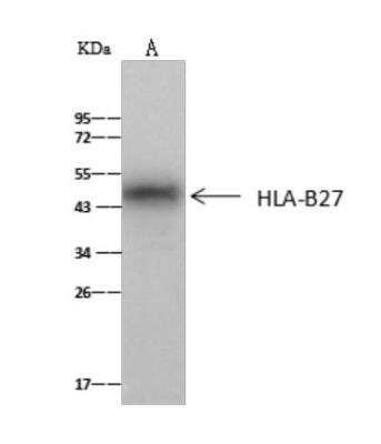 HLA B7 Antibody (NBP3-06118): Novus Biologicals