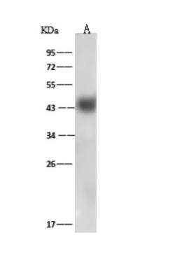 HLA B7 Antibody (NBP3-06118): Novus Biologicals