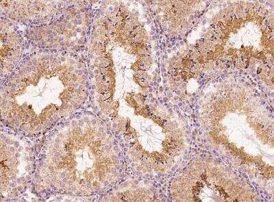 Isthmin 1/ISM1 Antibody (NBP3-06180): Novus Biologicals